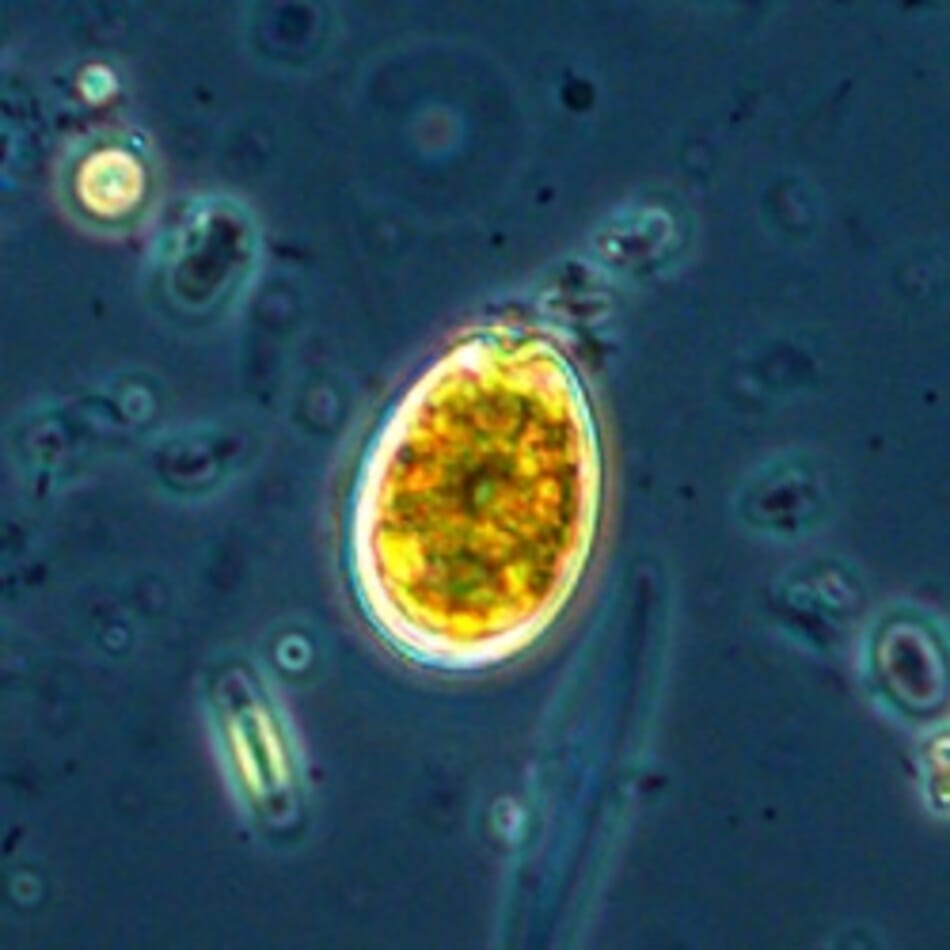 Researchers uncover hidden toxin risks in nutrient-starved algal blooms ...
