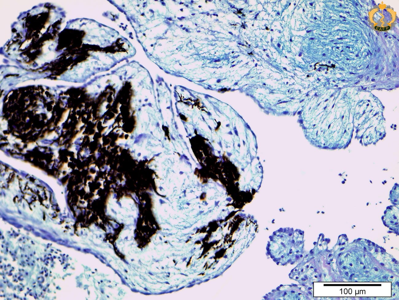 Fish pathology photo winner announced | The Fish Site