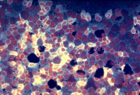 Infectious salmon anaemia (ISA) | Disease guide | The Fish Site